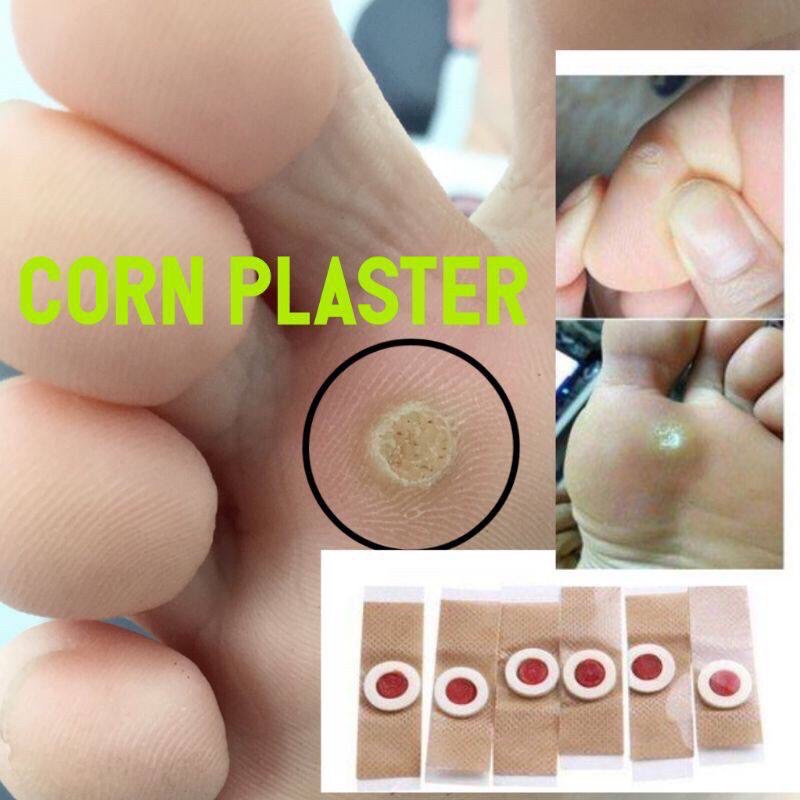 CORN PLASTER REMOVER 6Pcs Plaster ketuat kaki Tangan dan seluruh badan ...