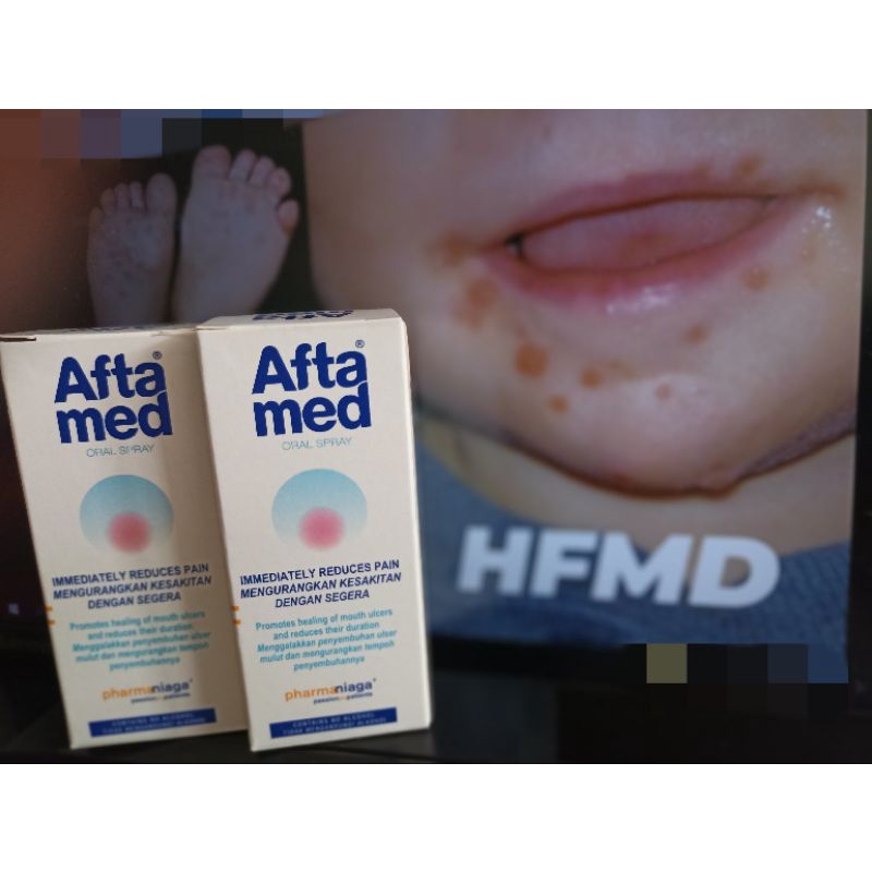 Aftamed Oral Spray 20ML | EXP 02/2025 / Hyaluronic Spray / Sore throat ...