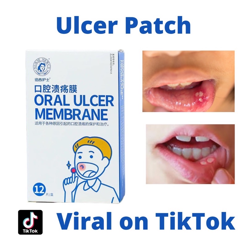 Oral Ulcer Patch Viral TikTok Ready Stock Malaysia | Shopee Malaysia