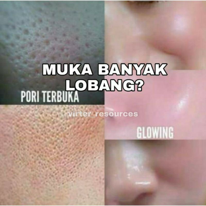 Serum muka sakura extract booster jerawat pori parut Acne Aging Sebum ...