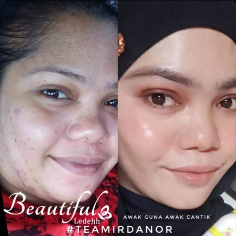 BL Skincare (Beautiful ledeh ) | Shopee Malaysia