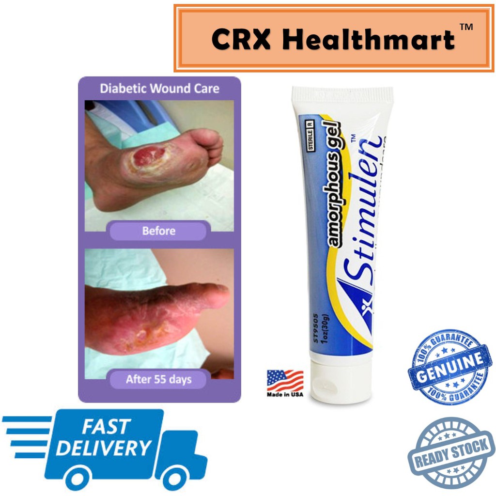 Stimulen Enhanced Collagen Woundcarel (1oz) | Shopee Malaysia