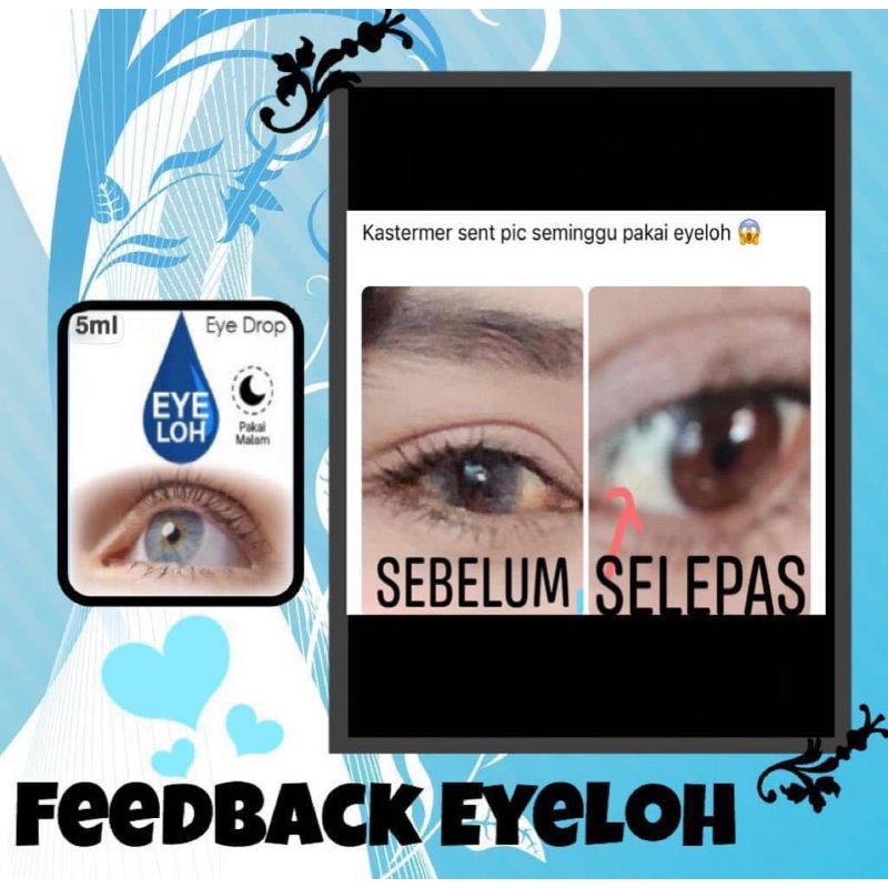 (Ubat Mata Eyeloh) Merawat Masalah RABUN, SILAU, KETARAK DLL | Shopee ...