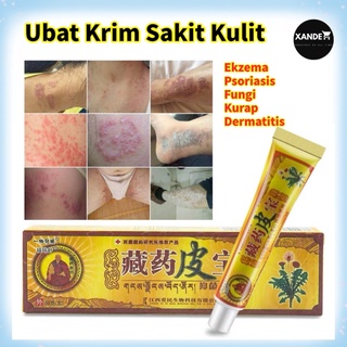 ubat gatal kulit - Prices and Promotions - Apr 2022 | Shopee Malaysia