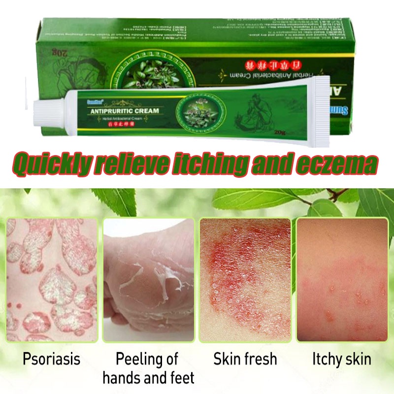 Eczema Cream Treatment Anti Bacterial Skin Fungus Cream Psoriasis ...