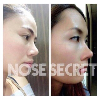 NOSE SECRET 3D alat pemancung hidung Mancungkan hidung kemek hidung ...