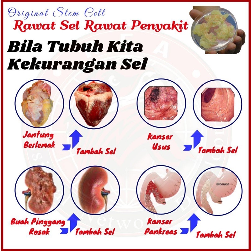 ICELL RAWAT SEL BINA SEL (Semenanjung) | Shopee Malaysia