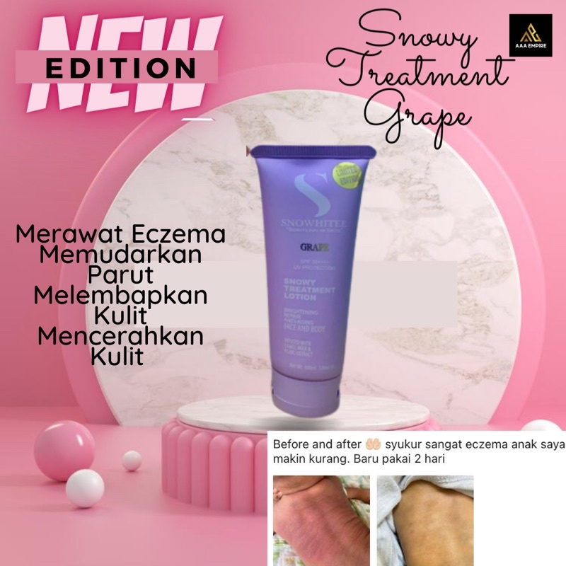 Snowhitee Original Snowy Treatment Lotion grape susu unta eczema kulit ...