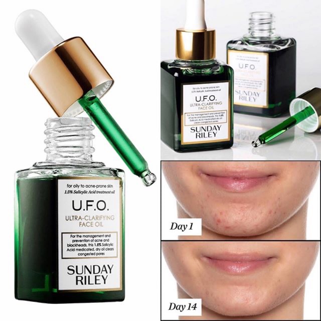 Sunday Riley Ufo 15ml | Shopee Malaysia