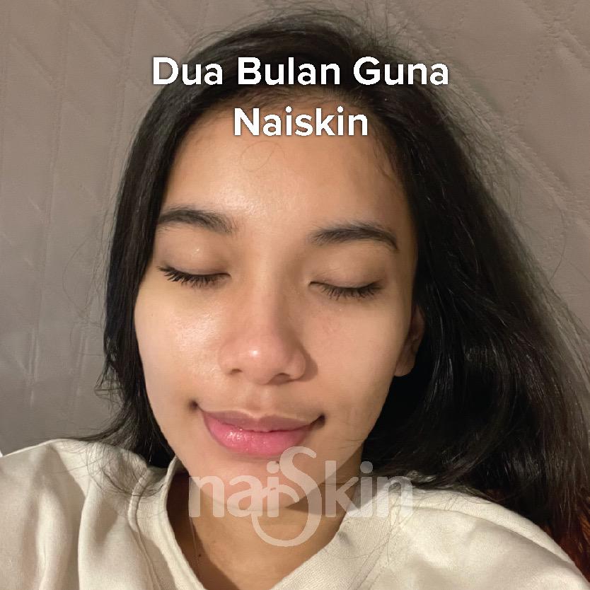 Naiskin, Online Shop | Shopee Malaysia