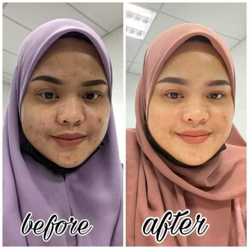 Skin Dessert ( Original Hq ) | Shopee Malaysia