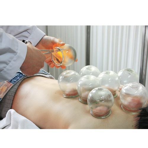 Mouthwash 玻璃拔罐器 火罐 Set Cupping Cup, Cawan Bekam, Chinese Medical glass ...