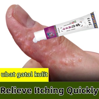 eczema Skincare cream psoriasis krim ubat gatal kulit Ubat Kurap ...