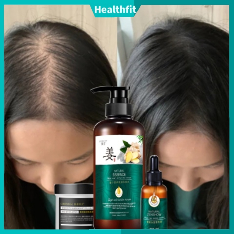 MY 24H Ship Ginger Hair Shampoo Growth Hair Shampo Syampu Rambut Gugur ...