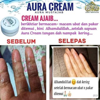 AURA CREAM AURA MUSTAJAB - RAWAT KURAP, KUDIS, GATAL2, PANAU, EKZEMA ...