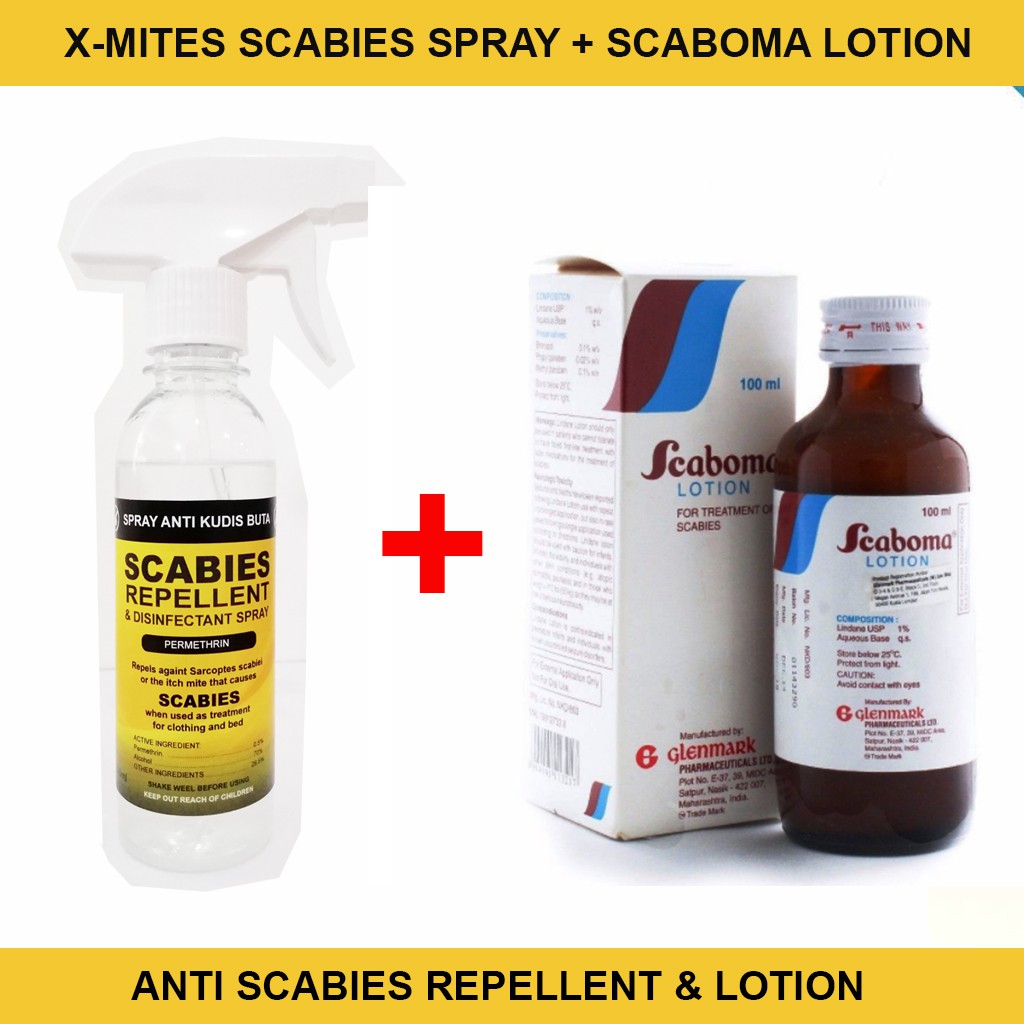 SCABOMA LOTION 100ML + X-MITE SCABIES SPRAY KUDIS BUTA 250ML | Shopee ...