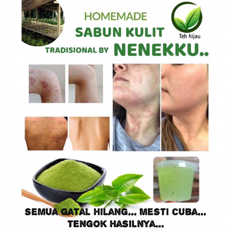 Sabun gatal tradisional homemade gatal,kudis,panau,ekzema,kurap ...