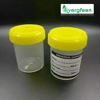 Specimen Container (Urine Container / Universal Container ) 60 ml with ...