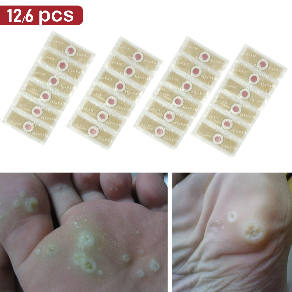 6PCS Plaster Foot Corn Removal Warts Thorn patches Corn of foot ...