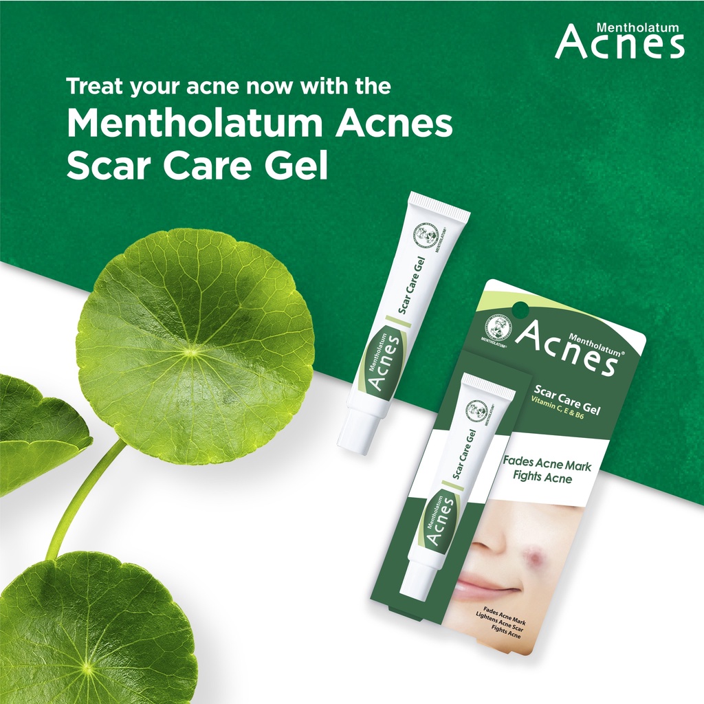 MENTHOLATUM ACNES Acnes Scar Care Gel 18g | Shopee Malaysia