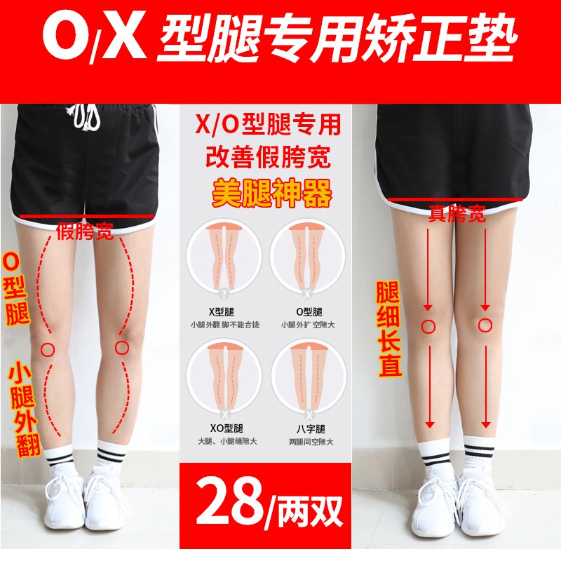 O-shaped leg orthopedic insoles foot valgus, eight-internal and eight ...