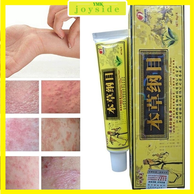 Original Herbal Creams Psoriasis Antipruritic Dermatitis and Eczema ...