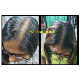 [READY STOCK ] Patti Mooligai Hair Root Fertilizer Tonic | Paati ...