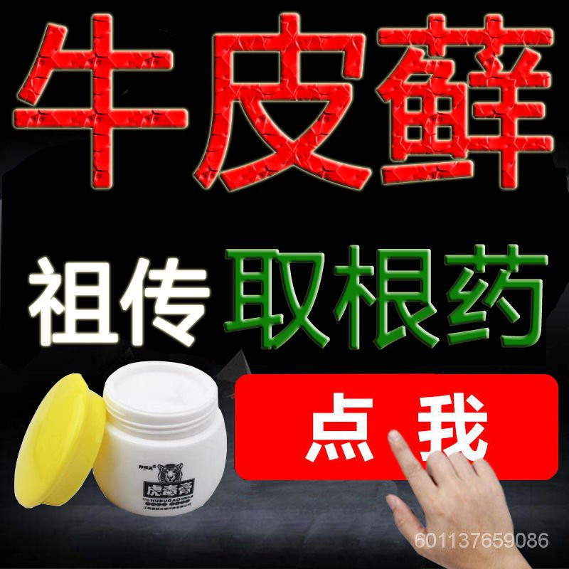 Tiger Poison Cream for Psoriasis Psoriasis Tinea Tinea Tinea Tinea ...