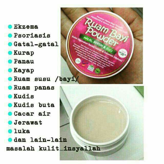 RUAM BAYI POWDER (PENAWAR PENYAKIT KULIT) | Shopee Malaysia