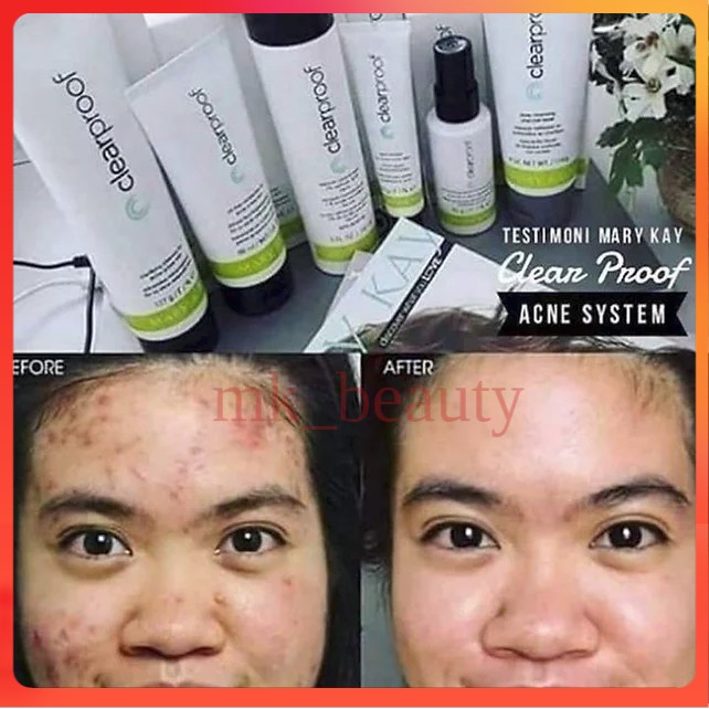 Clear Proof Acne System ClearProof Skincare Set Ready Stock | Shopee ...