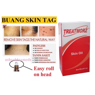 TREATMORZ SKIN OIL SKIN TAGS REMOVER 8ML | Shopee Malaysia