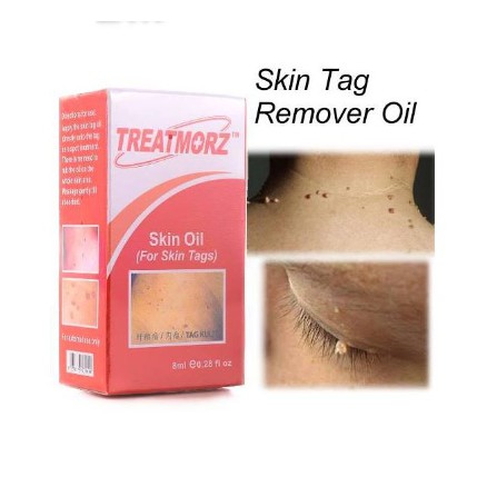 TREATMORZ SKIN OIL SKIN TAGS REMOVER 8ML | Shopee Malaysia