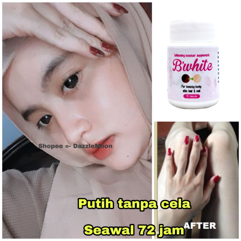 Kitsui Pinky Milk Strawberry *Masalah Jerawat, Diformulasikan khas ...