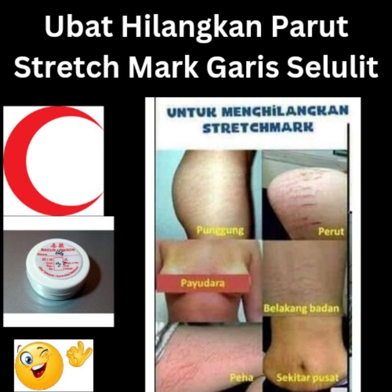 5g Krim Hilang Parut Luka Jahitan Parut Lama Badan Body Scar Removal Cream Operation Burn ...