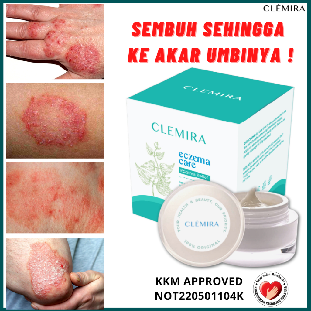 Clemira Eczema Cream Ubat Gatal Kulit Ubat Panau Ubat Kurap Ubat Gatal ...