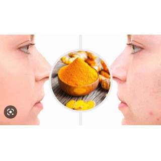 korkom powder / pure Turmic powder for beauty face | Shopee Malaysia