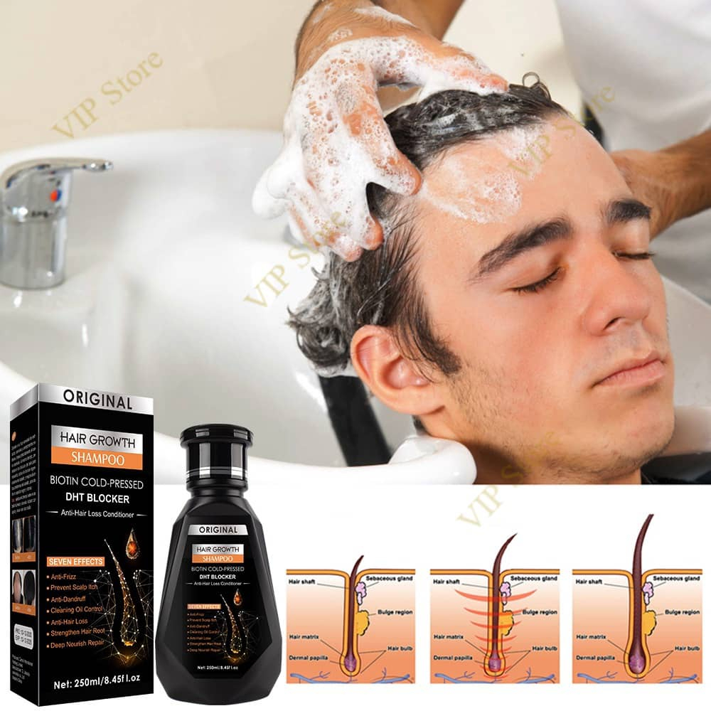 Hair Growth Essential Oil Biotin Cold Pressed Dht Blocker And Hair