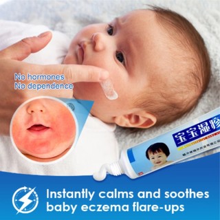 Baby Butt Rash Cream / Krim Ubat Gatal bayi 20g penyakit kulit & Nyamuk ...