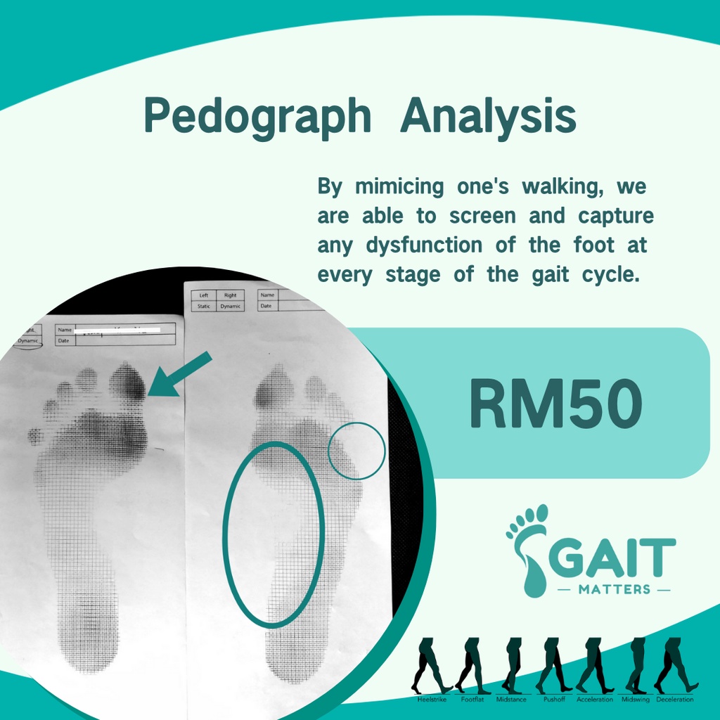 Pedograph Analysis - Dynamic Footprint Assessment - Gait Matters ...