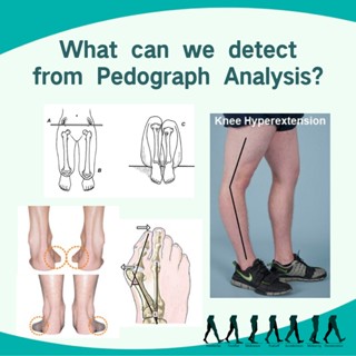 Pedograph Analysis - Dynamic Footprint Assessment - Gait Matters ...