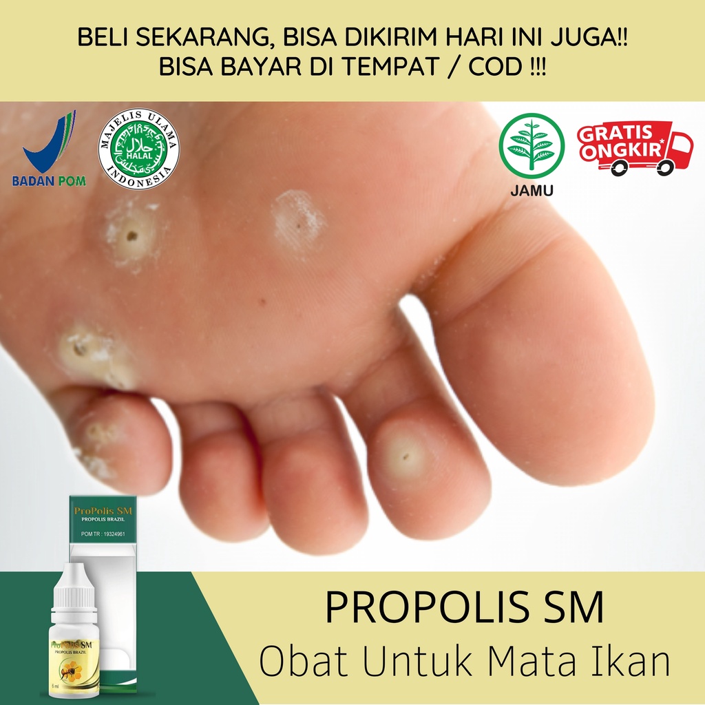 Herbal Medicine For Fish Eyes, Fish Eye Medicines On Hand Eyes, Fish ...