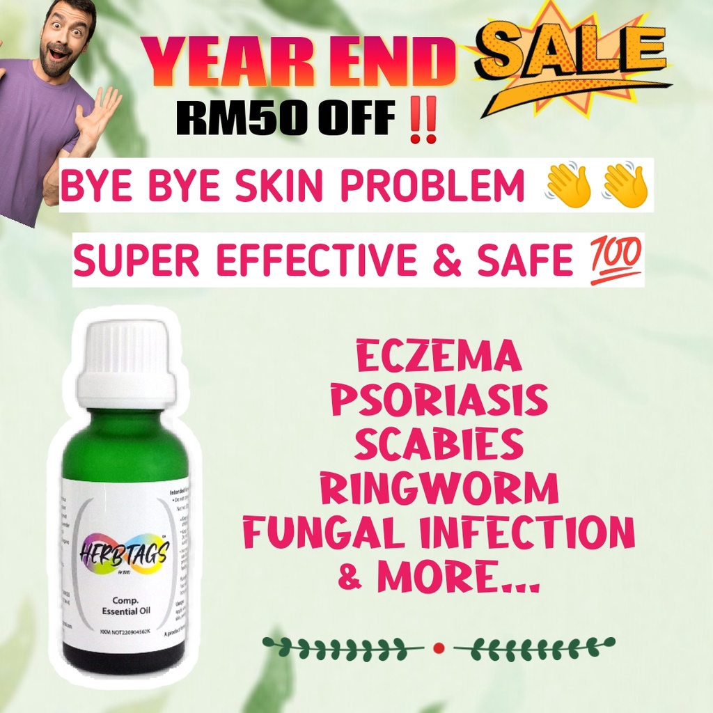 Natural Product Eczema Ekzema Psoriasis Ringworm Kurap Rashes Ruam ...