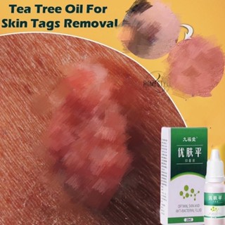Ubat buang kutil Skin Tag Mole Wart Removal ketuat tahi lalat biji ...