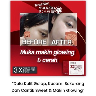 sabun sakura whitening booster viral | Shopee Malaysia