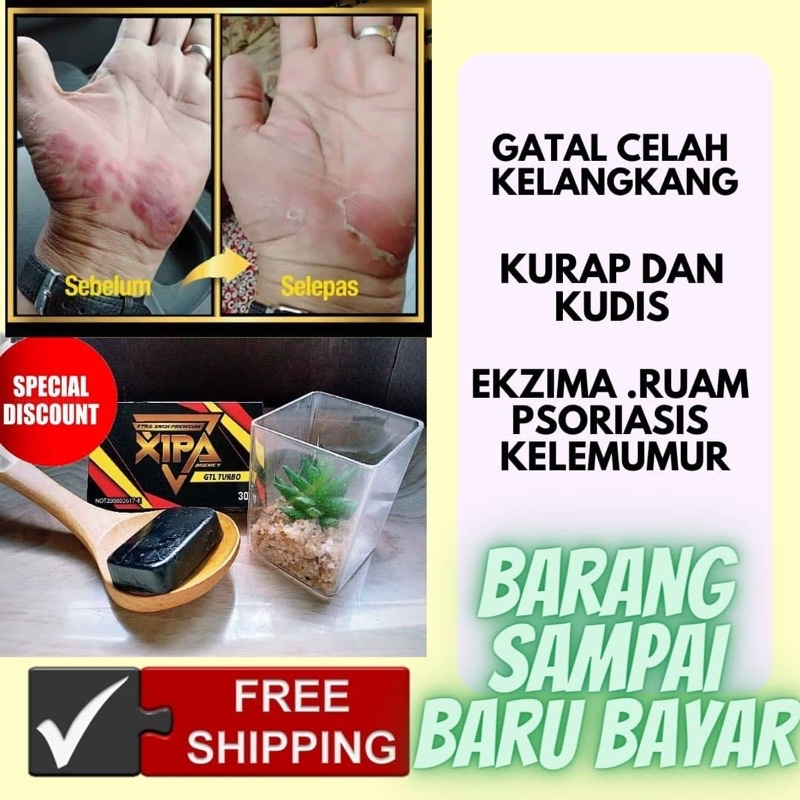 [VIRAL] SABUN MERAWAT KURAP GATAL PANAU EKZEMA KELIMUMUR | Shopee Malaysia
