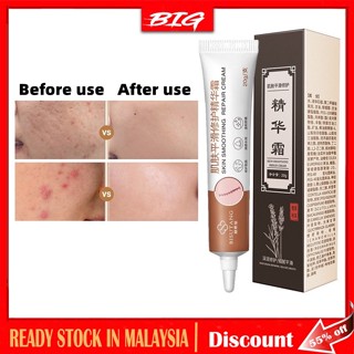 Scar Care Hilangkan Parut Ubat Hilangkan Parut Scar Remover Scar Cream ...