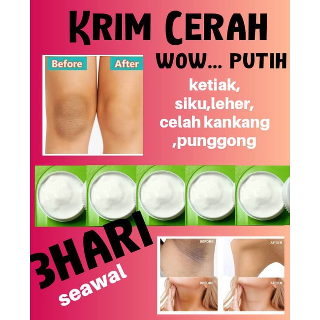 krim cerah /putih muka,hilang parut,putih ketiak, | Shopee Malaysia